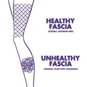 Fascia 101: What Is Fascia Stretching and Why It Matters