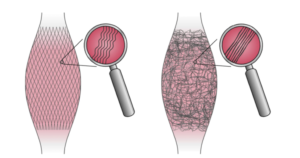 Fascia 101: What Is Fascia Stretching and Why It Matters